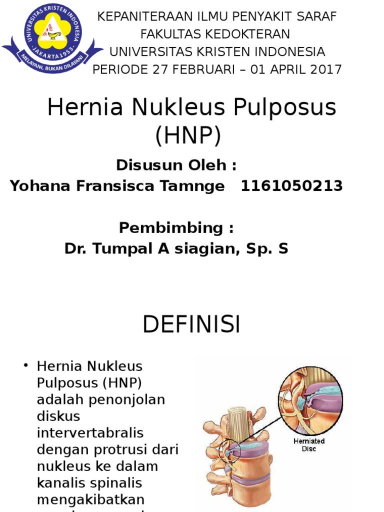 Hernia Nukleus Pulposus (HNP) | PDF