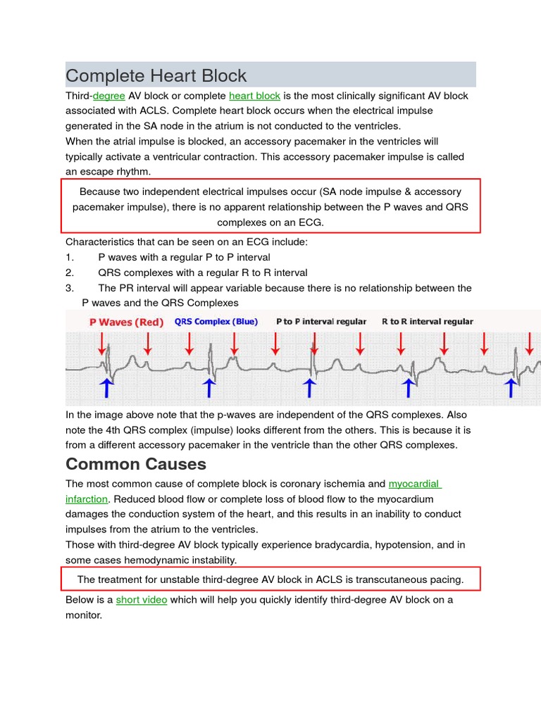 Complete Heart Block Overview and ACLS Treatment | PDF
