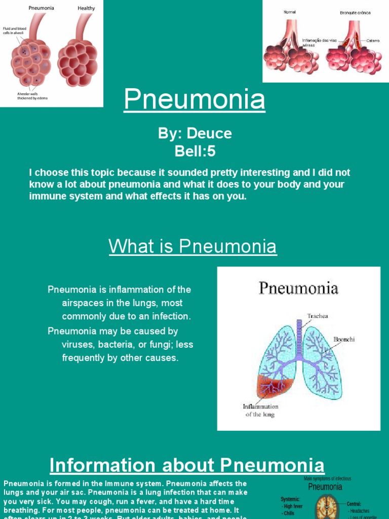 Understanding Pneumonia: Causes & Effects | PDF | Science & Mathematics