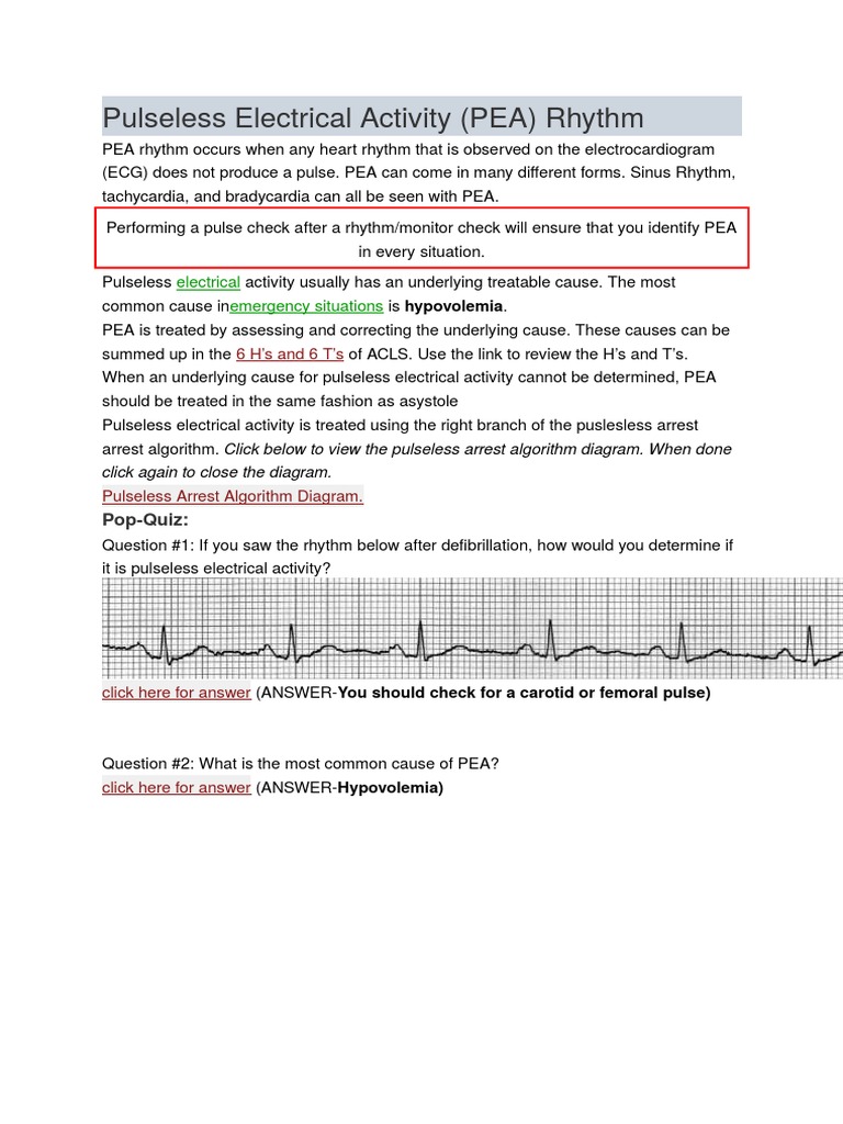 Pulseless Electrical Activity