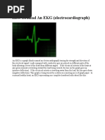 Reading EKGs For Beginners | PDF | Atheroma | Electrocardiography