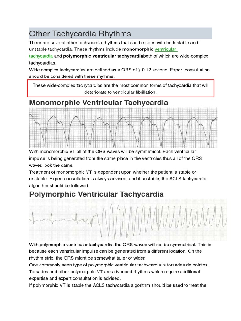 Other Tachycardia Rhythms