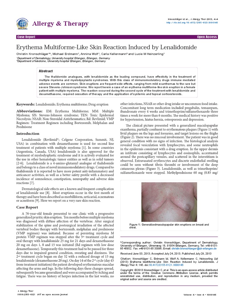Erythema Multiforme Like Skin Reaction Induced by Lenalidomide 2155 ...