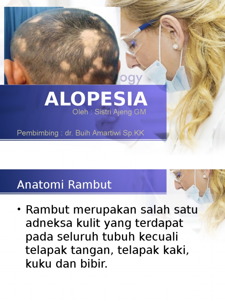 Alopesia | PDF