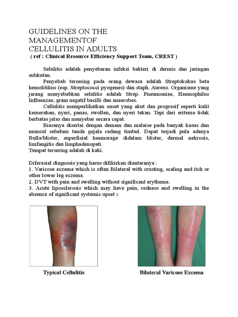 Selulitis | PDF