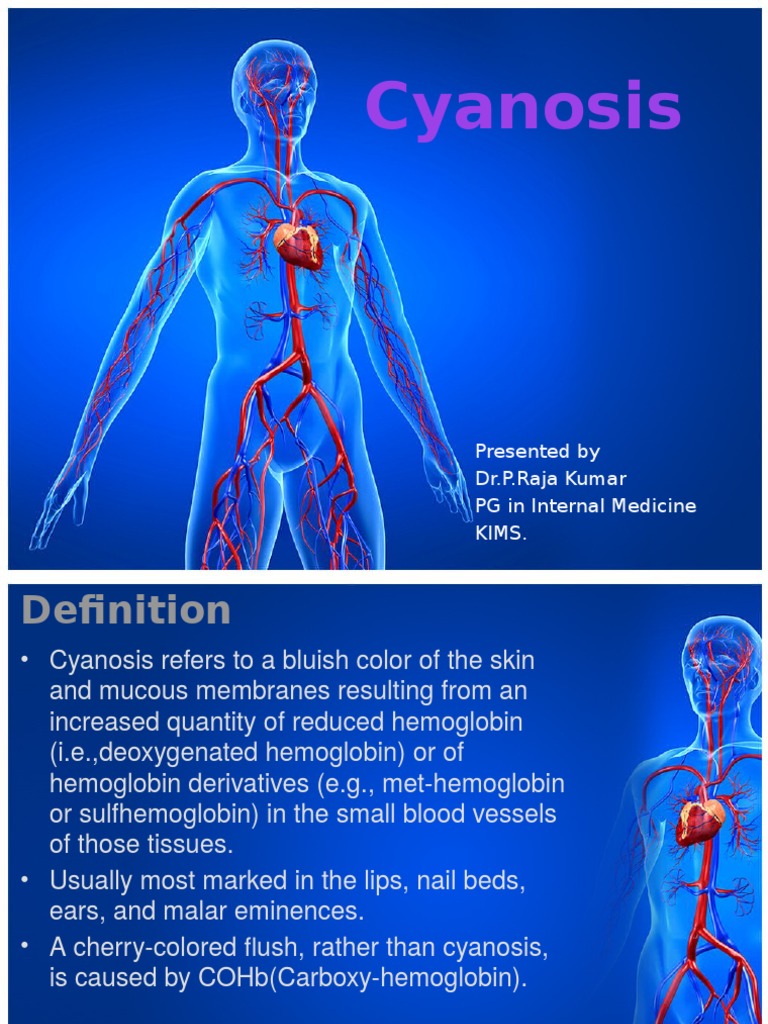 Cyanosis | PDF | Hemoglobin | Lung