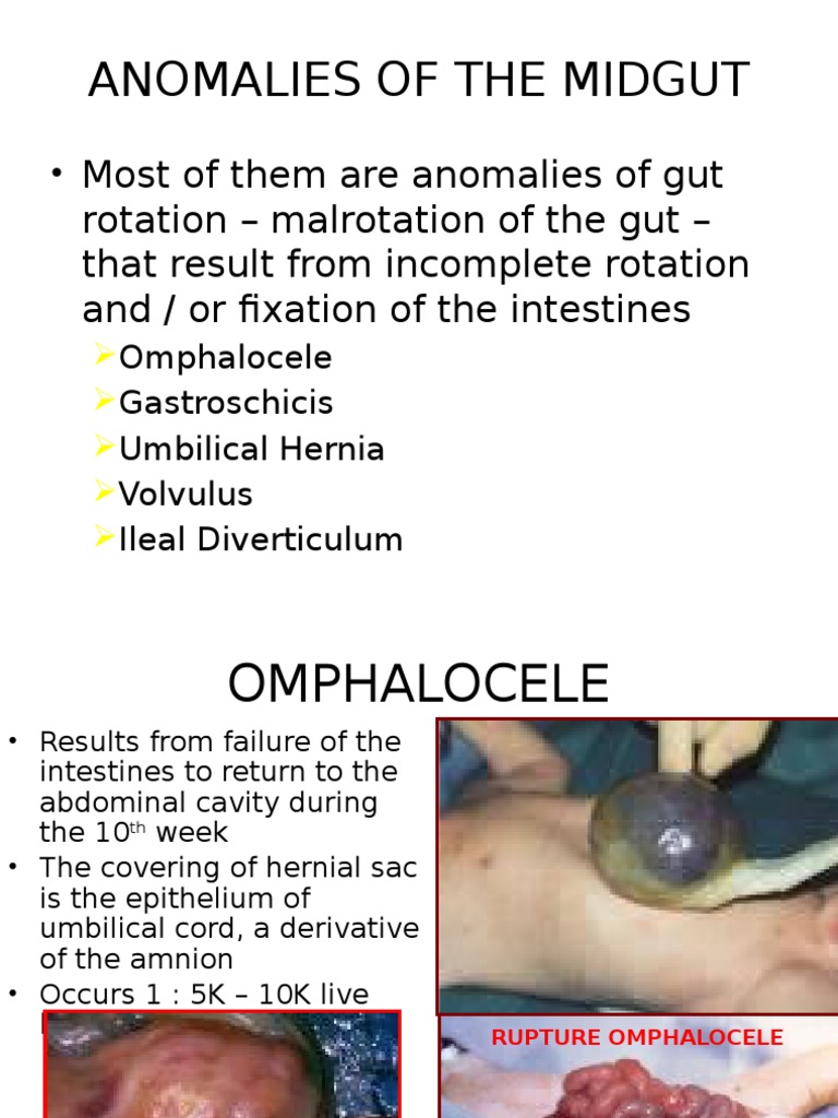 Anomalies of The Midgut | PDF | Science & Mathematics