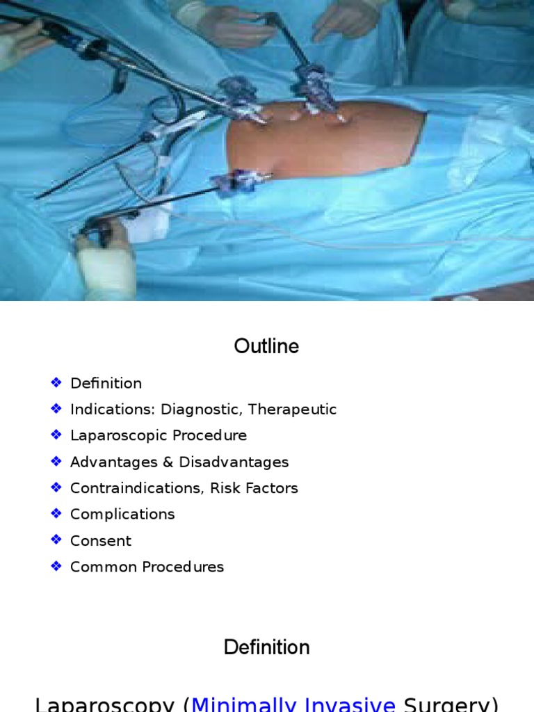 Laparoscopy | Surgery | Abdomen