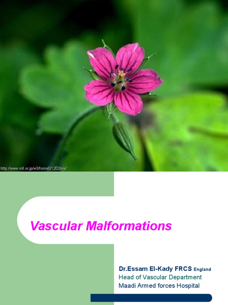 Vascular Malformations | PDF | Angiography | Angiology