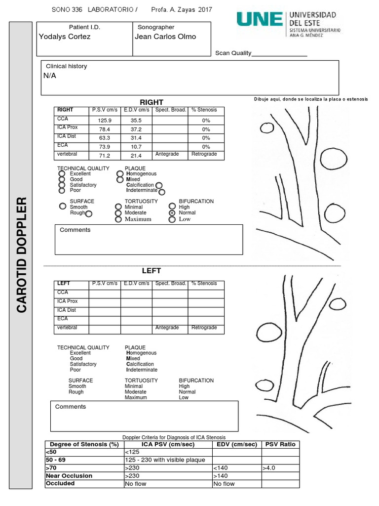 Carotid Doppler Ultrasound Report Template | PDF