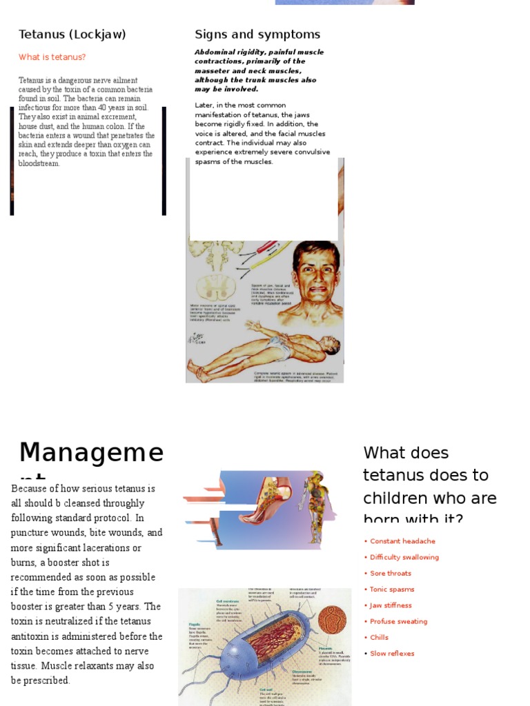 Tetanus (Lockjaw) Signs and Symptoms | PDF