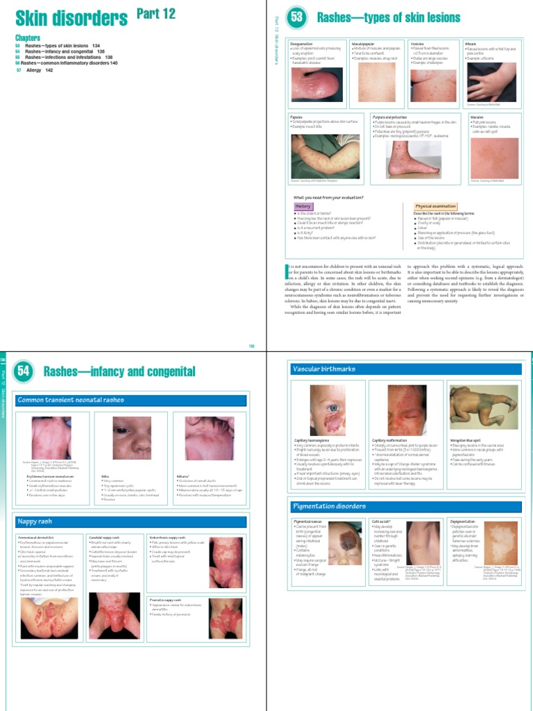 Paediatrics at A Glance - Rash 4 Pages Per Page | PDF | Cutaneous ...
