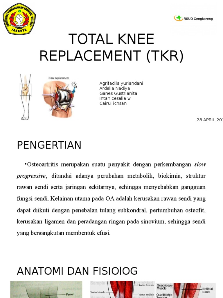 Total Knee Replacement (TKR) | PDF | Kesehatan Holistik