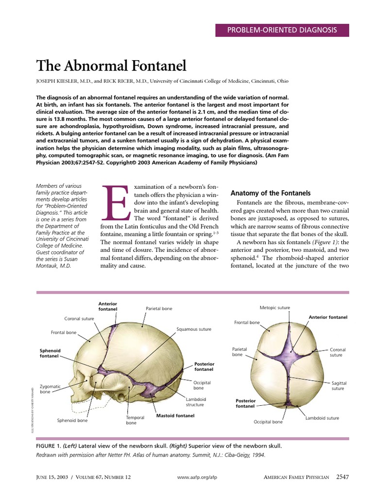 Fontanelas Anormales PDF | PDF | Skull | Congenital Disorder