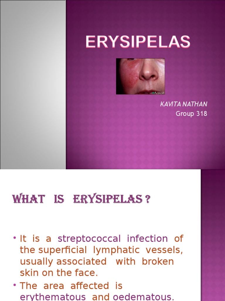 Erysipelas | PDF | Health Sciences | Medical Specialties