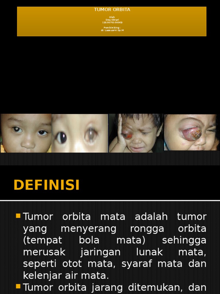 Atumor Orbita | PDF | Sains & Matematika