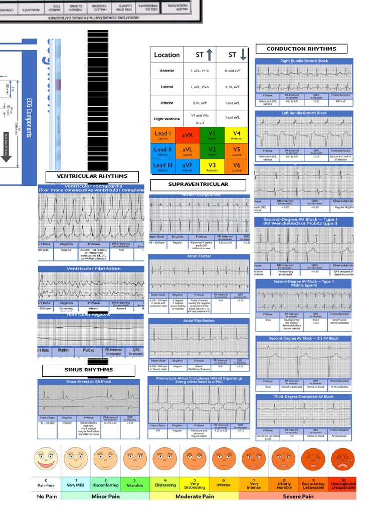 ECG Rhythms Poster | PDF