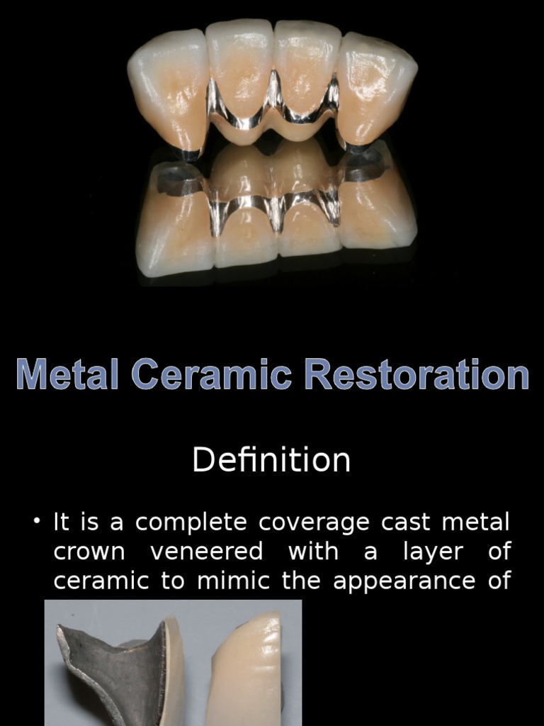 3 - Modified METAL-CERAMIC RESTORATION SB 09132015 | PDF | Ceramics ...