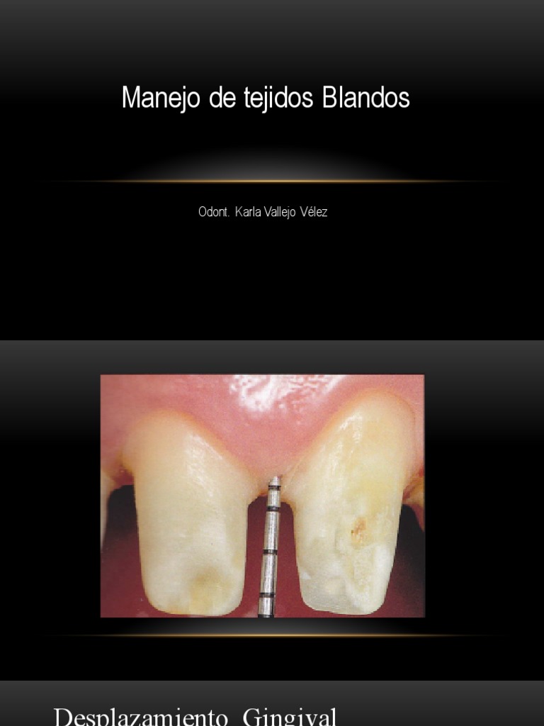 Manejo de Tejidos Blandos | PDF | Dental Degree | Periodontology