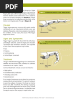 Trigger Finger | PDF | Surgery | Finger