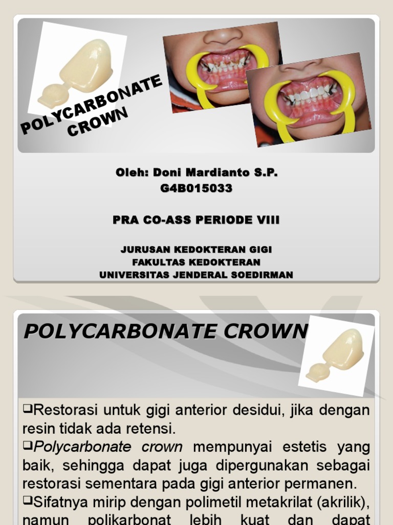 PCC | PDF