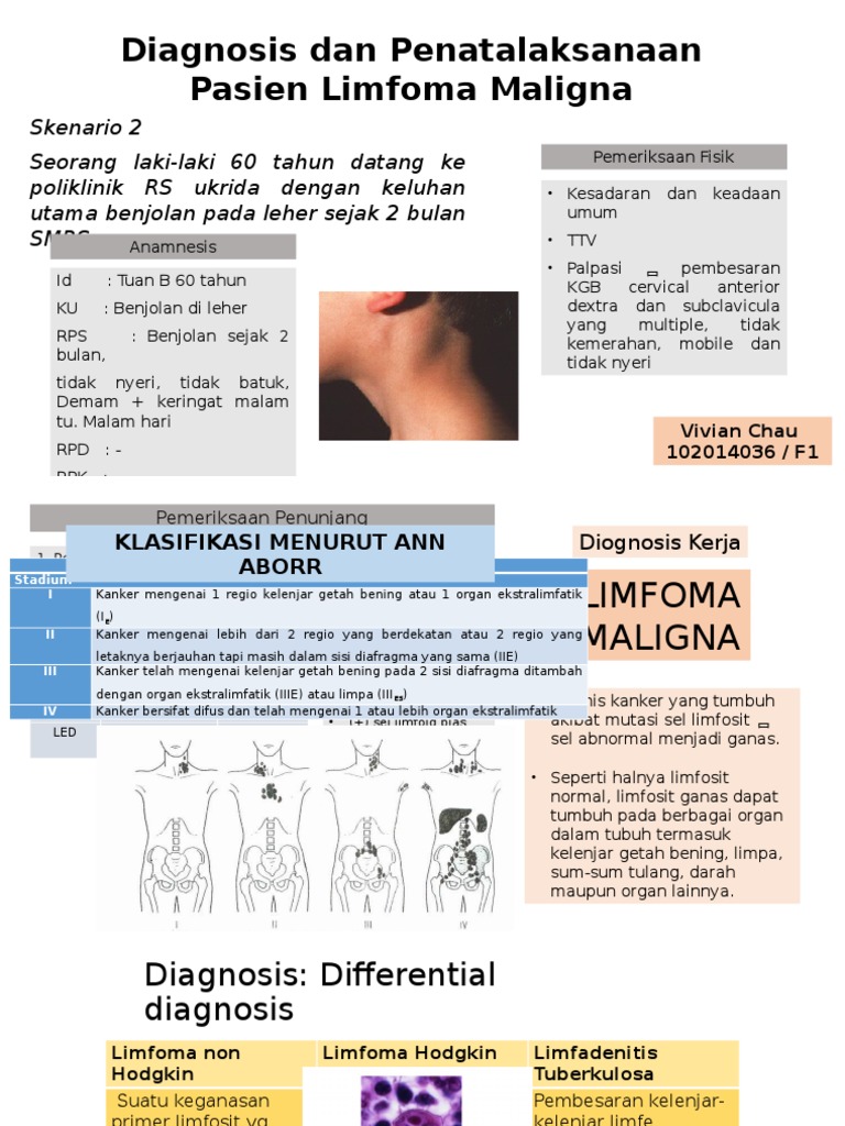 Panduan Limfoma Maligna | PDF