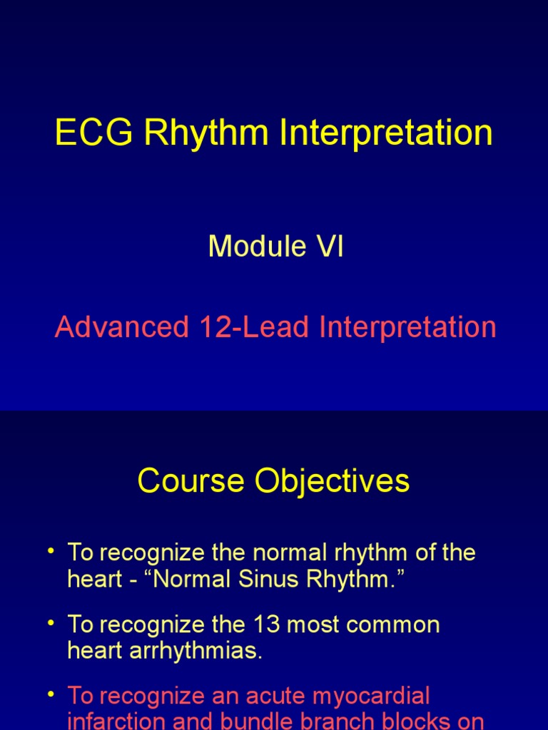 Advanced 12-Lead ECG Interpretation | PDF | Electrocardiography ...