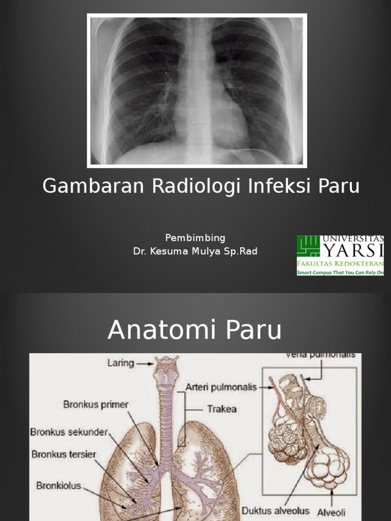 Radiologi Infeksi Paru Sasha | PDF | Perjalanan | Seni