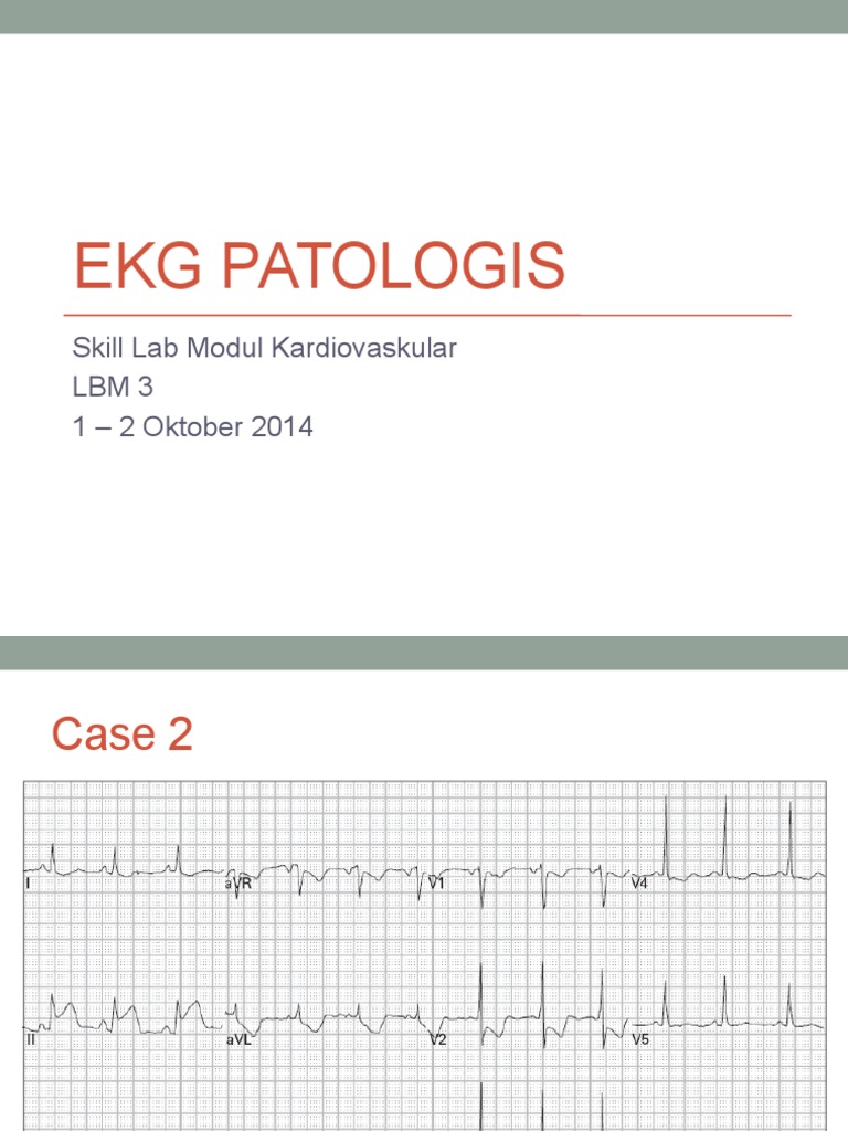 Skill EKG Patologis 1 | PDF