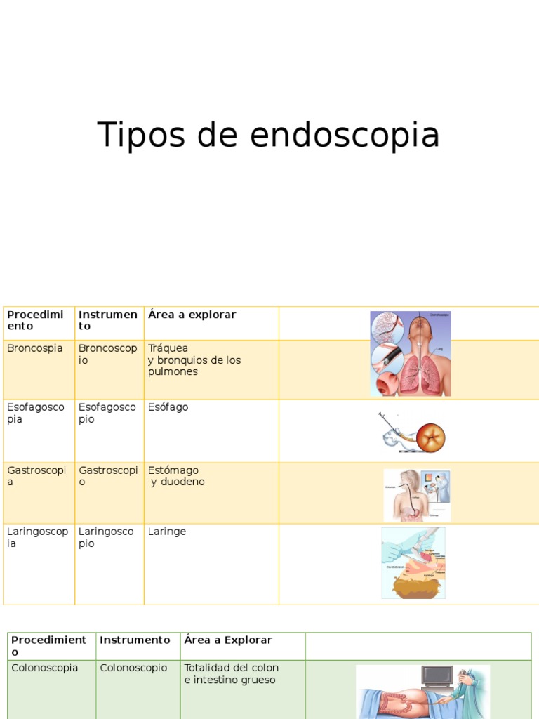 Tipos de Endos | PDF