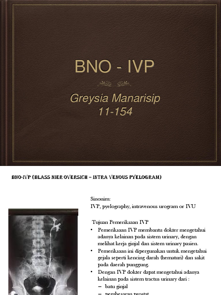 Bno Ivp | PDF