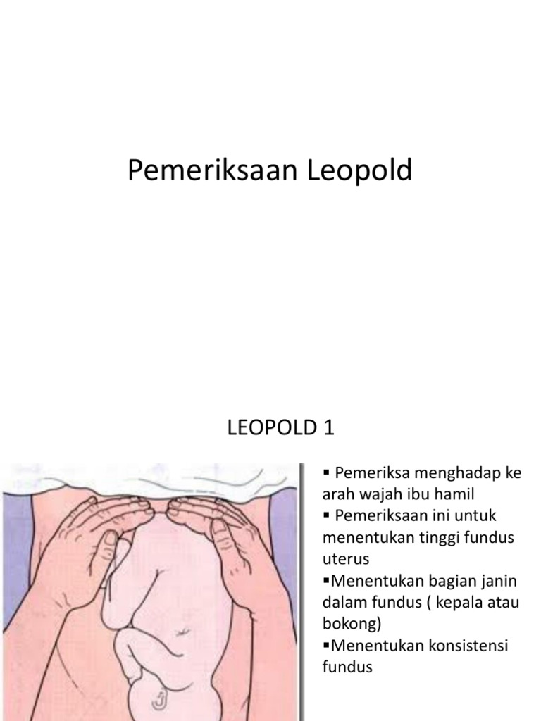 Pemeriksaan Leopold | PDF