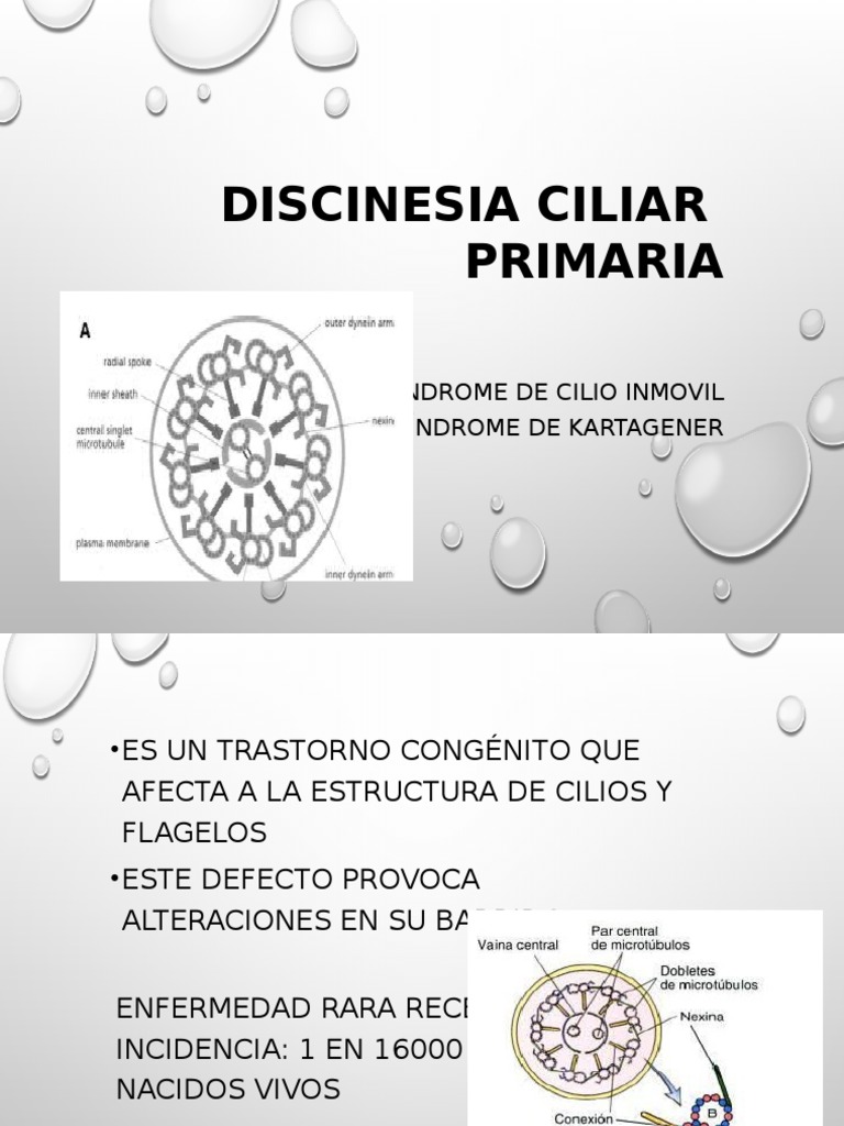 Discinesia Ciliar | PDF