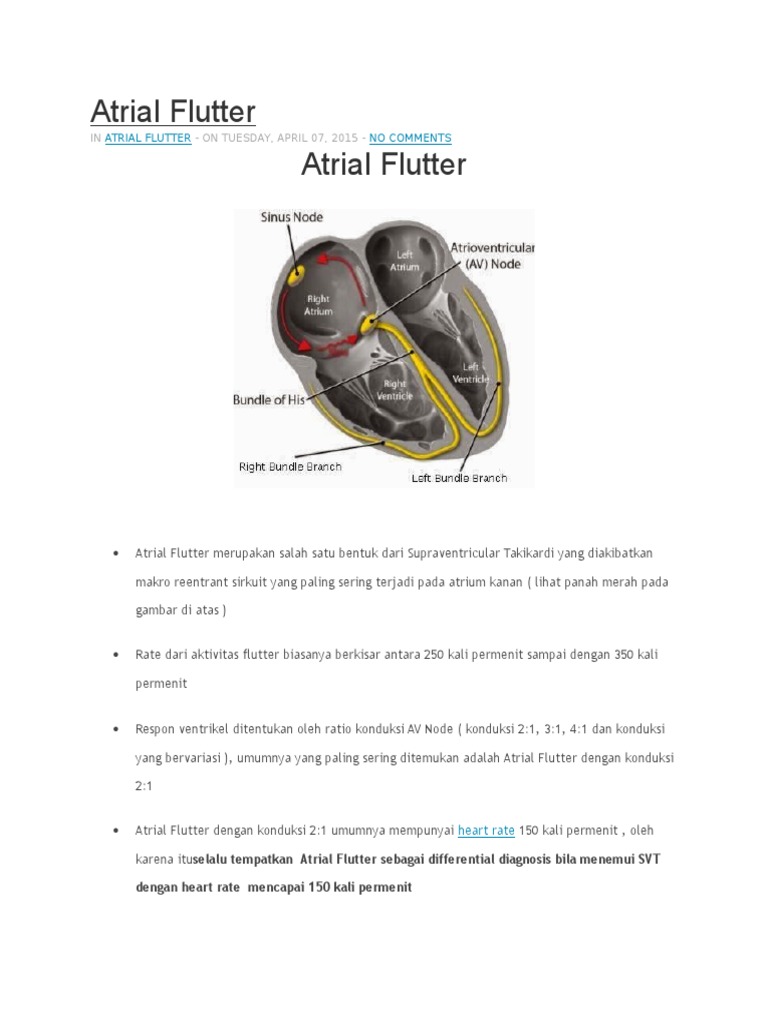 Atrial Flutter | PDF