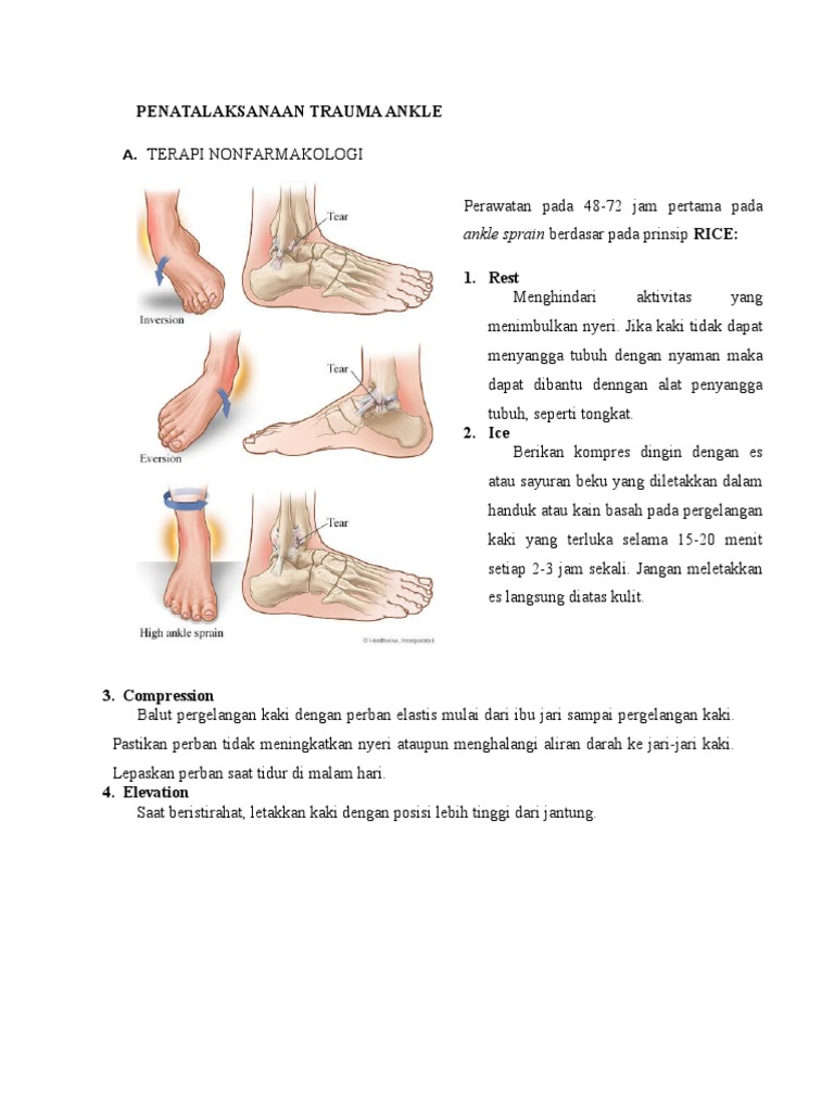 Tatalaksana Trauma Ankle dengan RICE | PDF