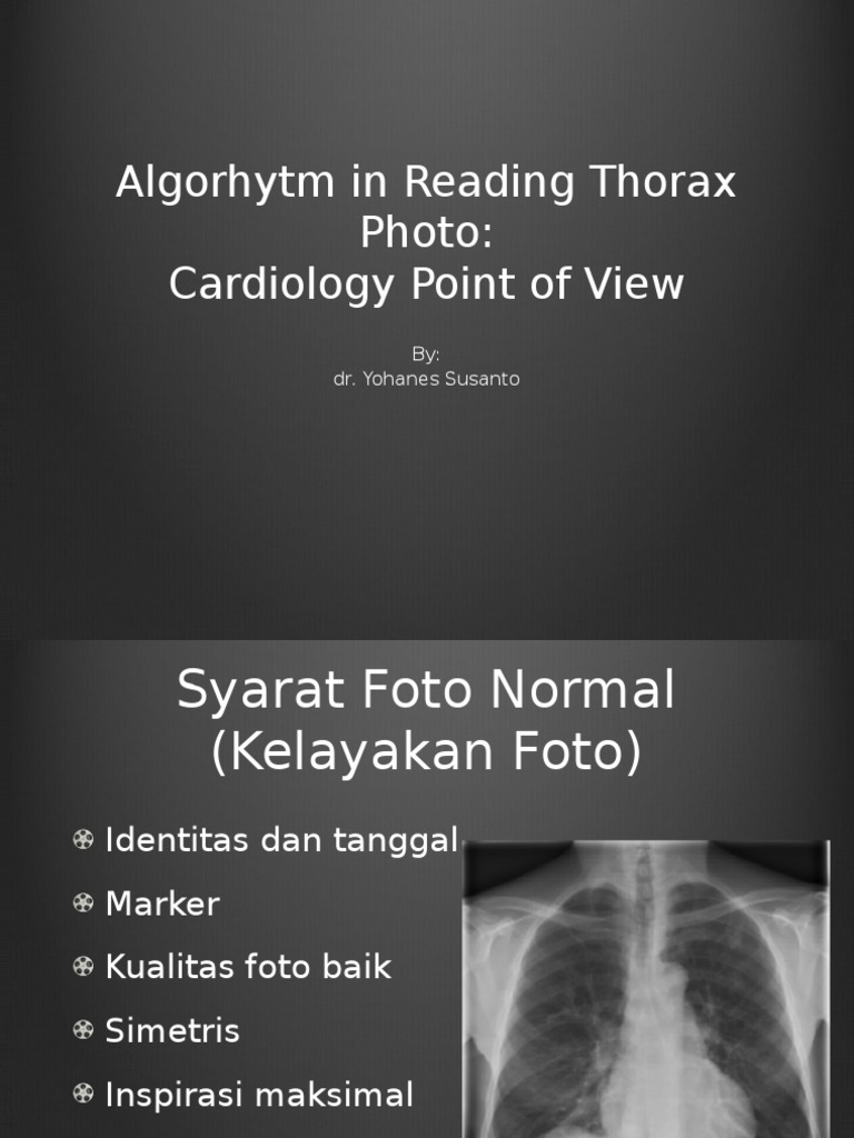 Gambaran Thorax Normal dalam Kardiologi | PDF