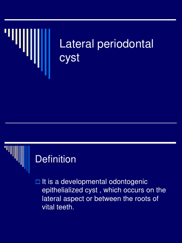Lateral Periodontal Cyst | PDF