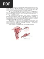 Understanding Pathological Retraction Ring | PDF | Childbirth | Uterus
