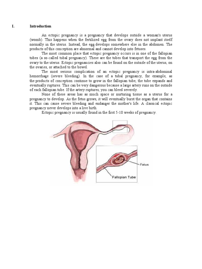 Ectopic Pregnancy - CS | PDF | Medical Specialties | Clinical Medicine