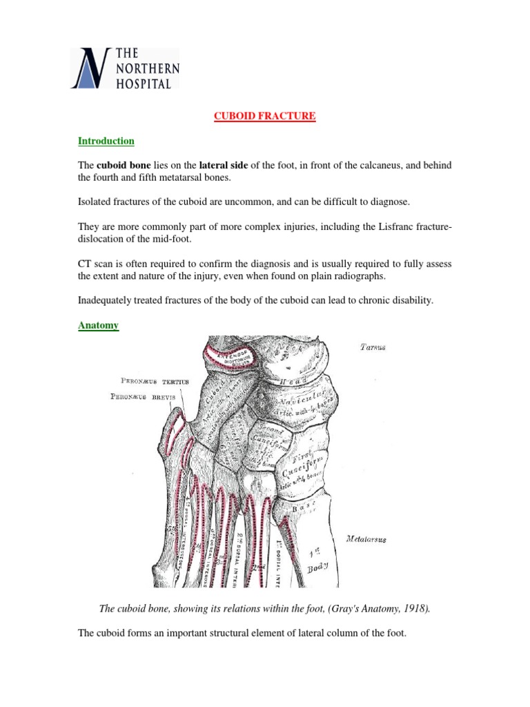 A Comprehensive Review of Cuboid Fractures: Anatomy, Mechanisms of ...