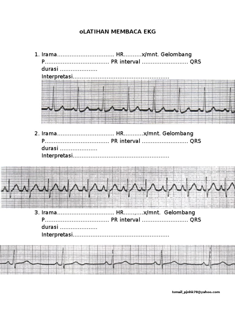 Latihan Membaca Ekg 118 | PDF