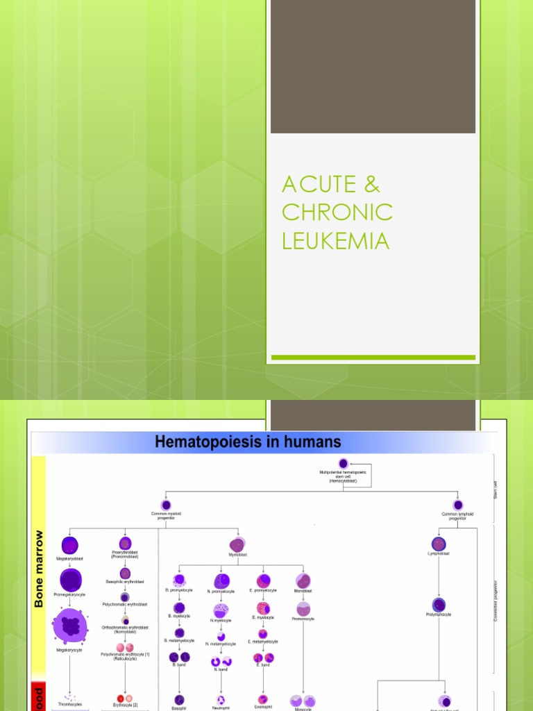 Acute and Chronic Leukemia Final | PDF | Leukemia | White Blood Cell