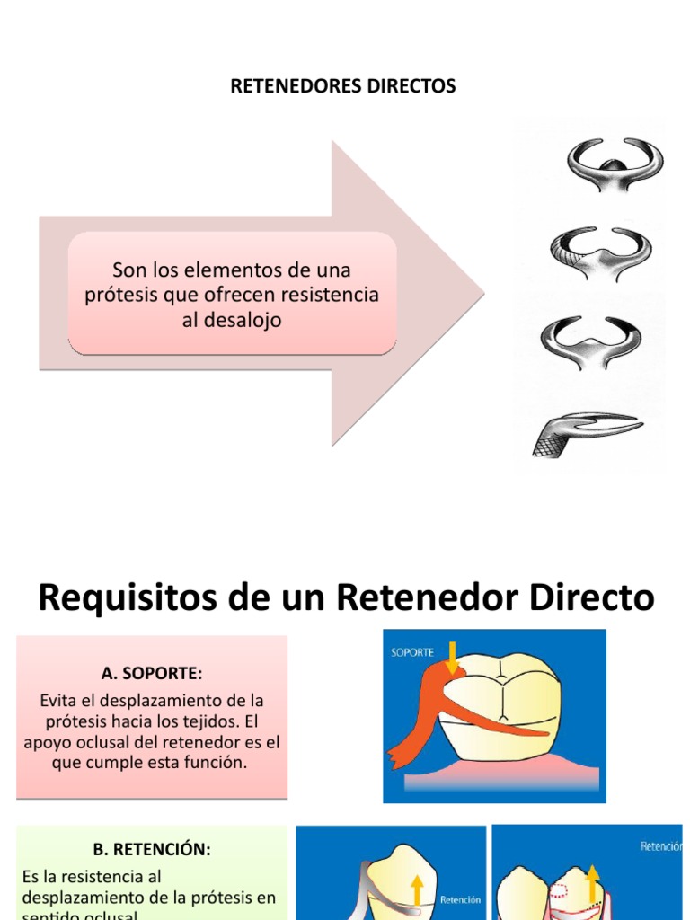 Retenedores Directos | PDF | Dentadura postiza | Diente humano
