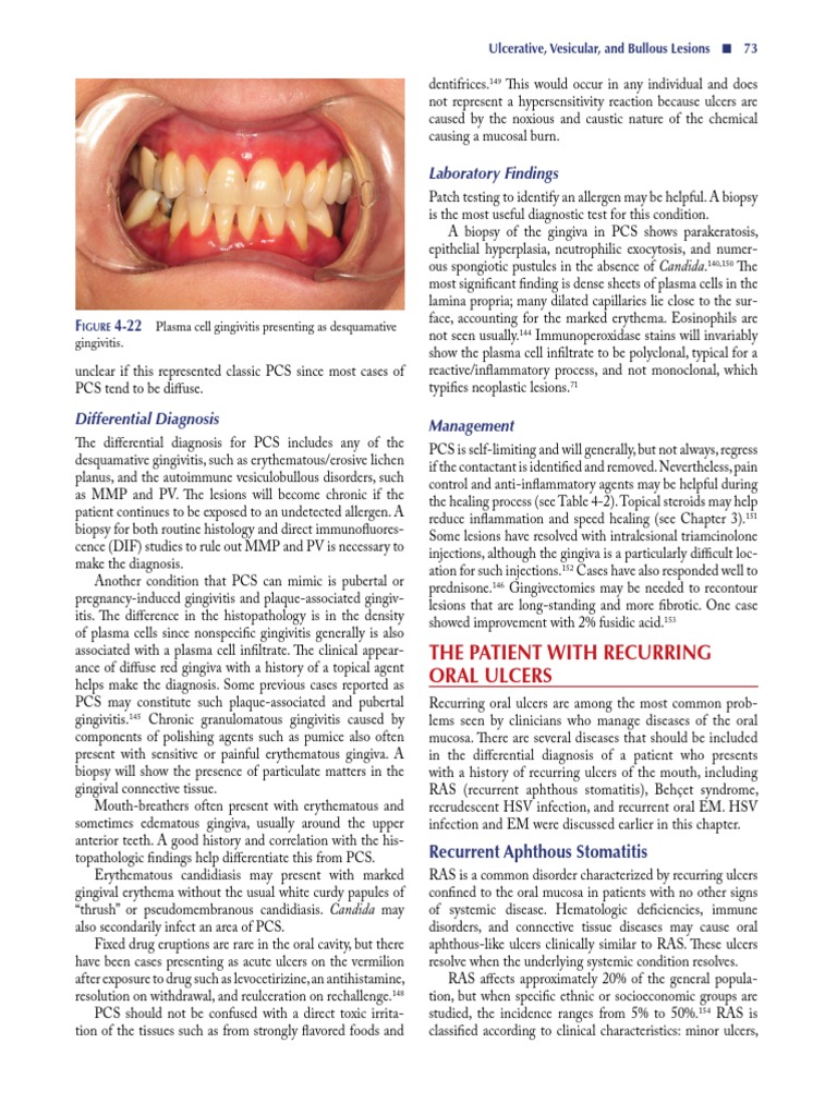 Laboratory Findings: The Patient With Recurring Oral Ulcers | PDF ...