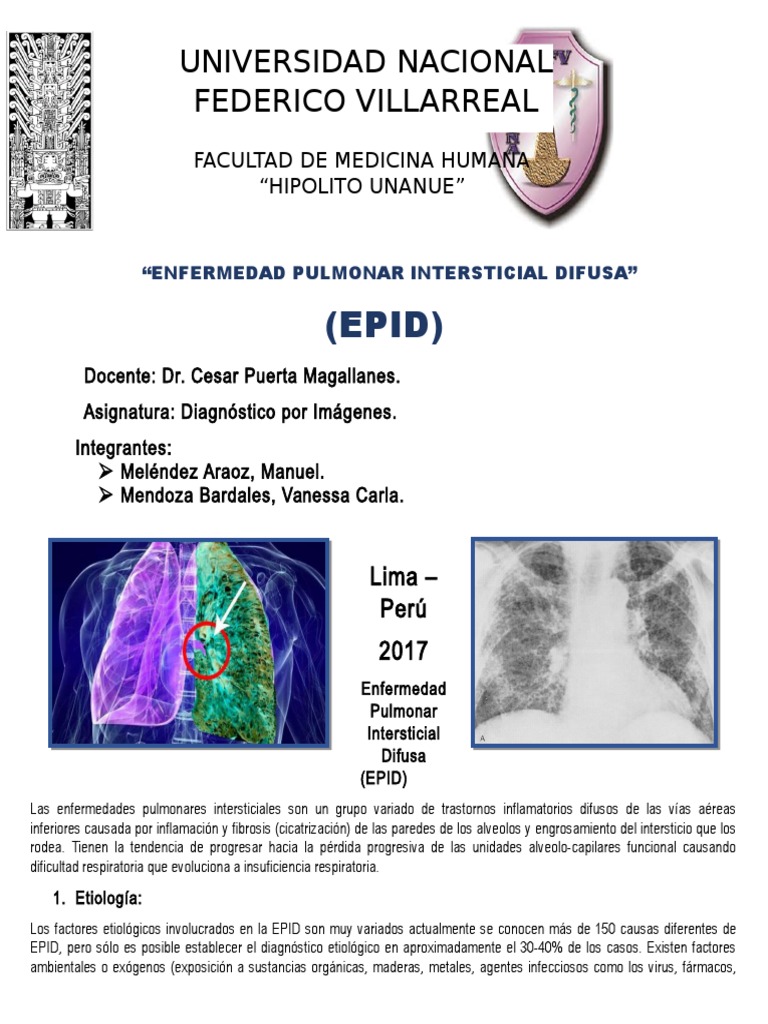 Enfermedad Pulmonar Intersticial Difusa | Neumonía | Diagnóstico médico