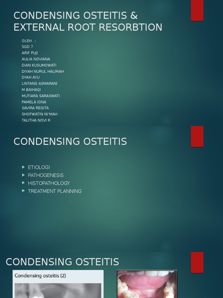 Condensing Osteitis & External Root Resorbtion | PDF