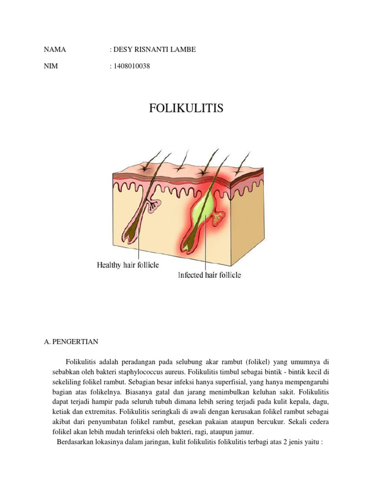 Folikulitis Word | PDF