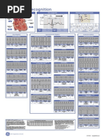 ICU One Pager External Pacemakers v11 | PDF | Artificial Cardiac ...
