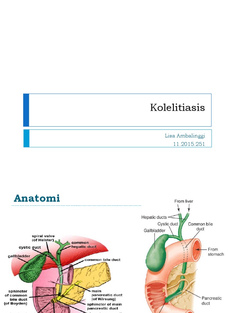Kolelitiasis | PDF