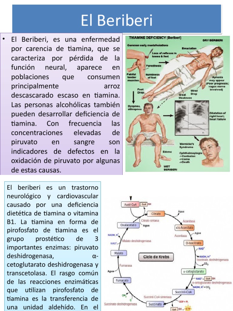 El Beriberi | PDF
